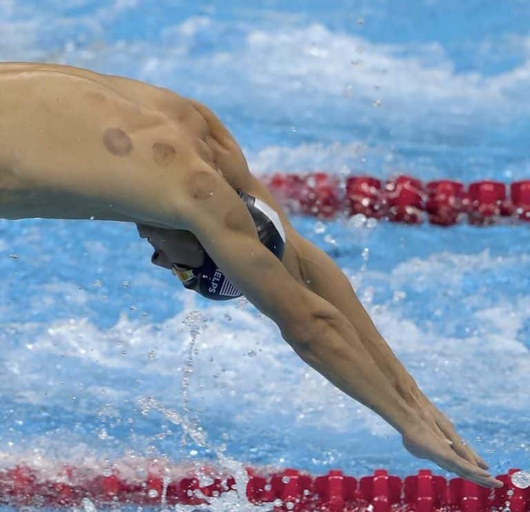 5 Amazing Health Benefits of Fire Cupping – The Clinic Health Group